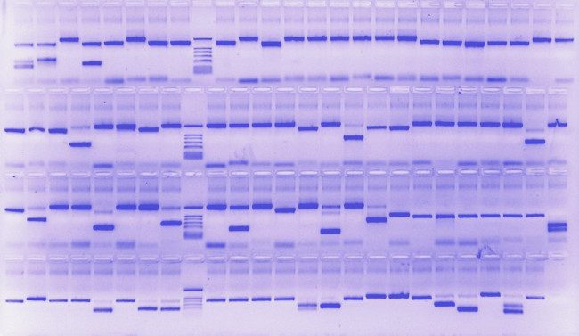 Structural chromosomal abnormalities | Share4Rare